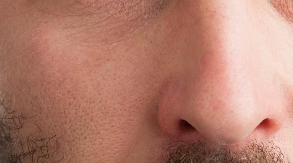 Tip of man’s nose bitten off in horror brawl at Tweed bus stop