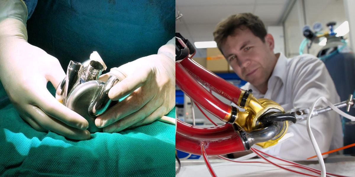 Aussie Man Lives Over 100 Days with New Titanium Heart